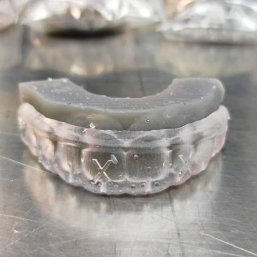 Lammina Dental Veneers with Six Month Smiles